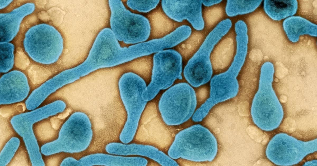 Marburg virus in Ethiopia — first outbreak recorded on November 15